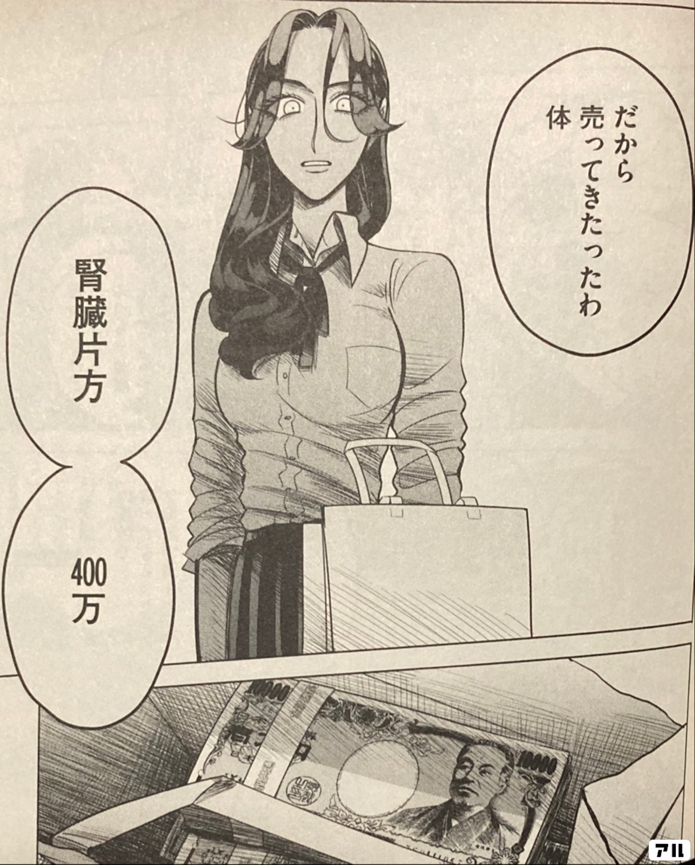だから売ってきたったわ体 腎臓片方400万 - 来世は他人がいい | アル だから売ってきたったわ体 腎臓片方400万 - 来世は他人がいい | アル